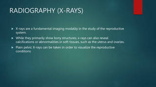 REPRODUCTIVE SYSTEM PPT.pptx radiographic | PPTX