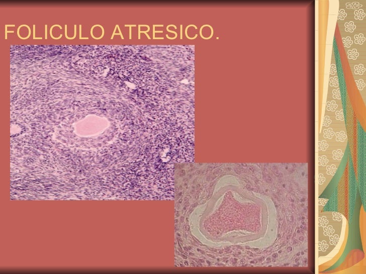 Reproductor Femenino