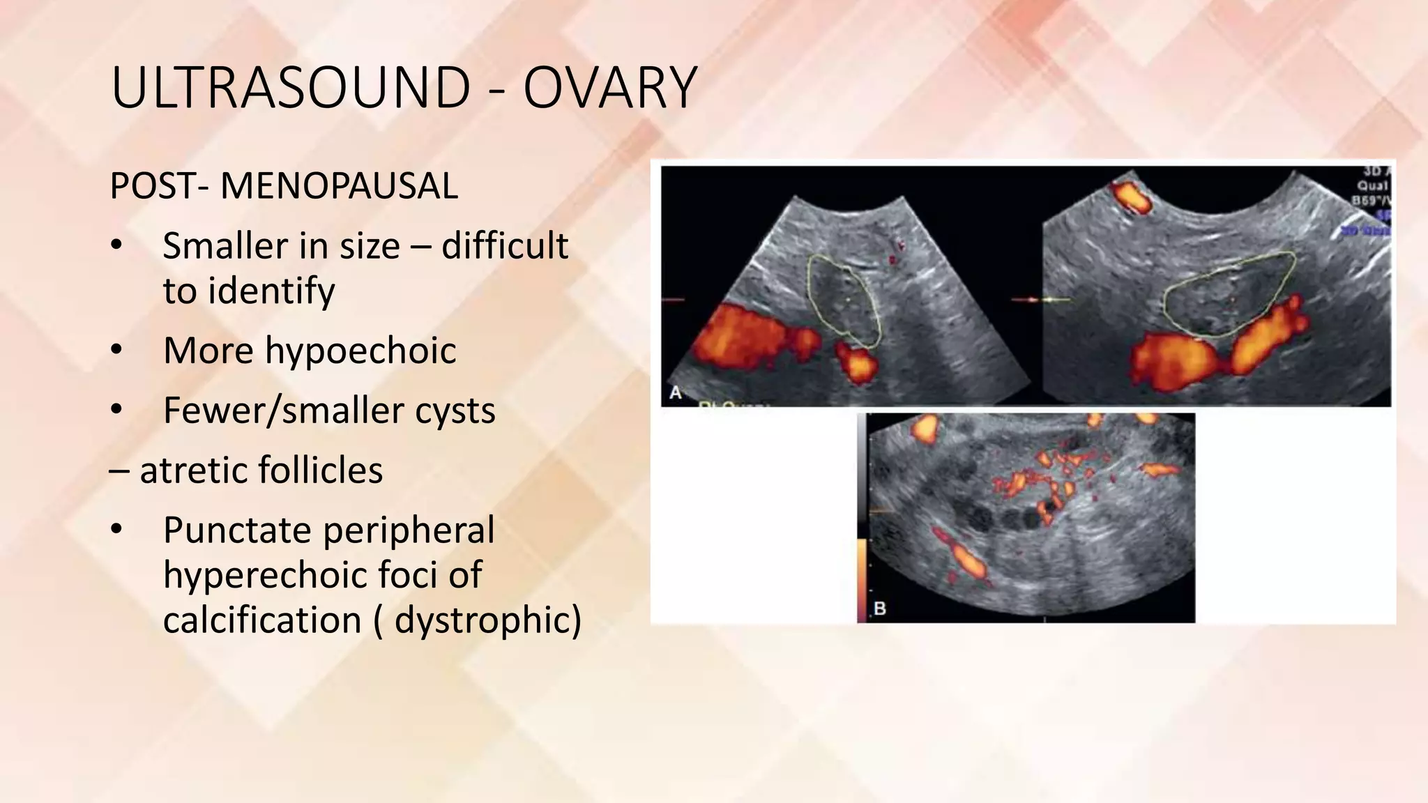 Imaging of female reproductive system RV | PPTX