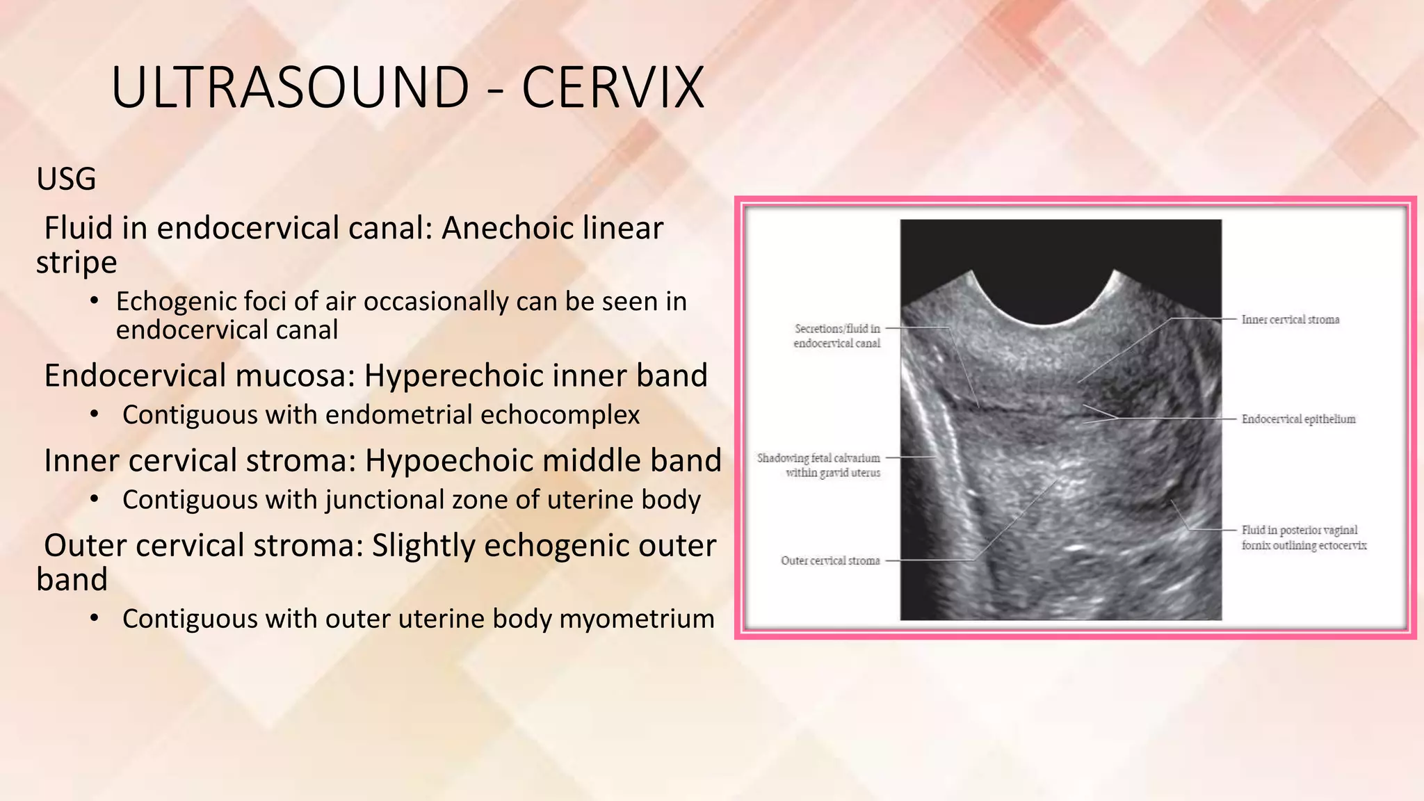 Imaging of female reproductive system RV | PPTX