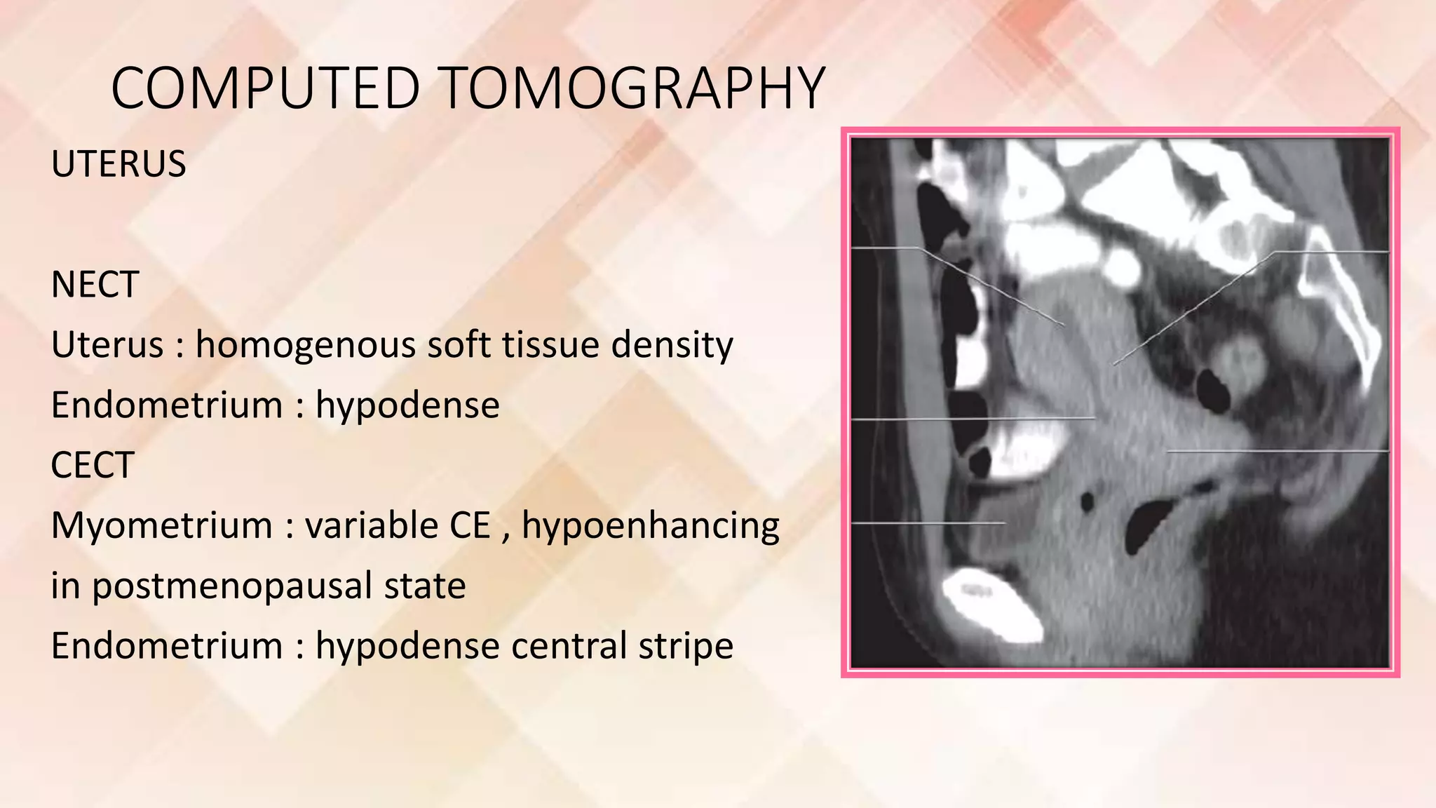 Imaging of female reproductive system RV | PPTX
