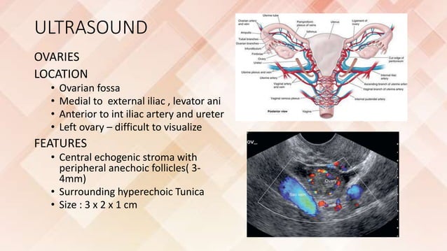 Imaging of female reproductive system RV | PPTX