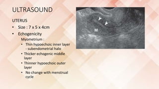 Imaging of female reproductive system RV | PPTX