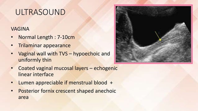 Imaging of female reproductive system RV | PPTX
