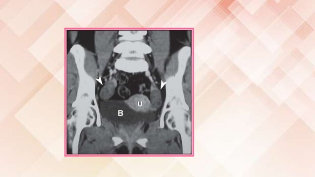 Imaging of female reproductive system RV | PPTX