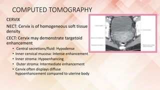 Imaging of female reproductive system RV | PPTX