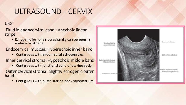 Imaging of female reproductive system RV