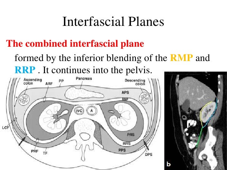 Reproteritoneum Anatomy and Pathology