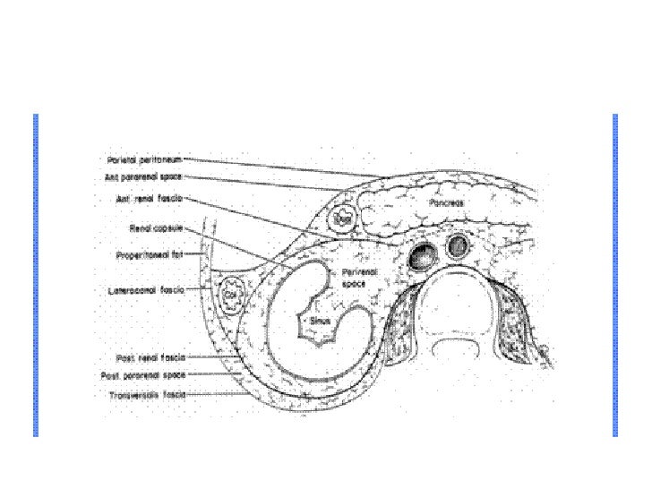 Retroperitoneal Perirenal Retroperitoneum Fascia Hemorrhage Gerota ...