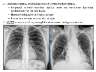 Respiratory pulmonary disease | PPTX