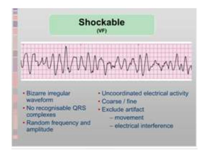Rescuscitation principles