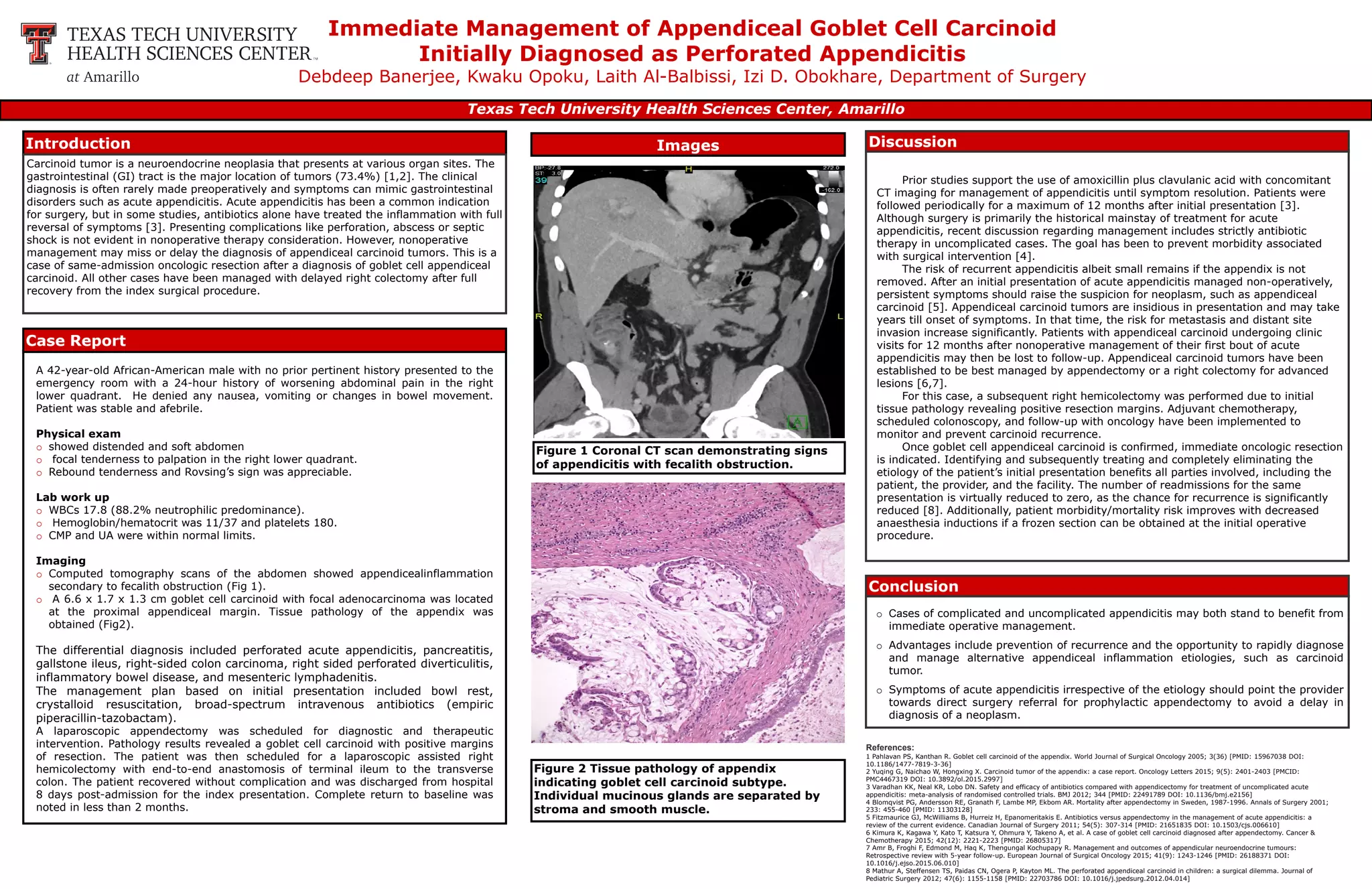 Immediate Management of Appendiceal Goblet Cell Carcinoid Initially ...