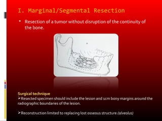 Resection oral surgery (very simplified) | PPT