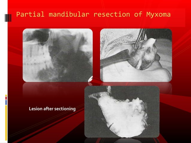 Resection oral surgery (very simplified) | PPT