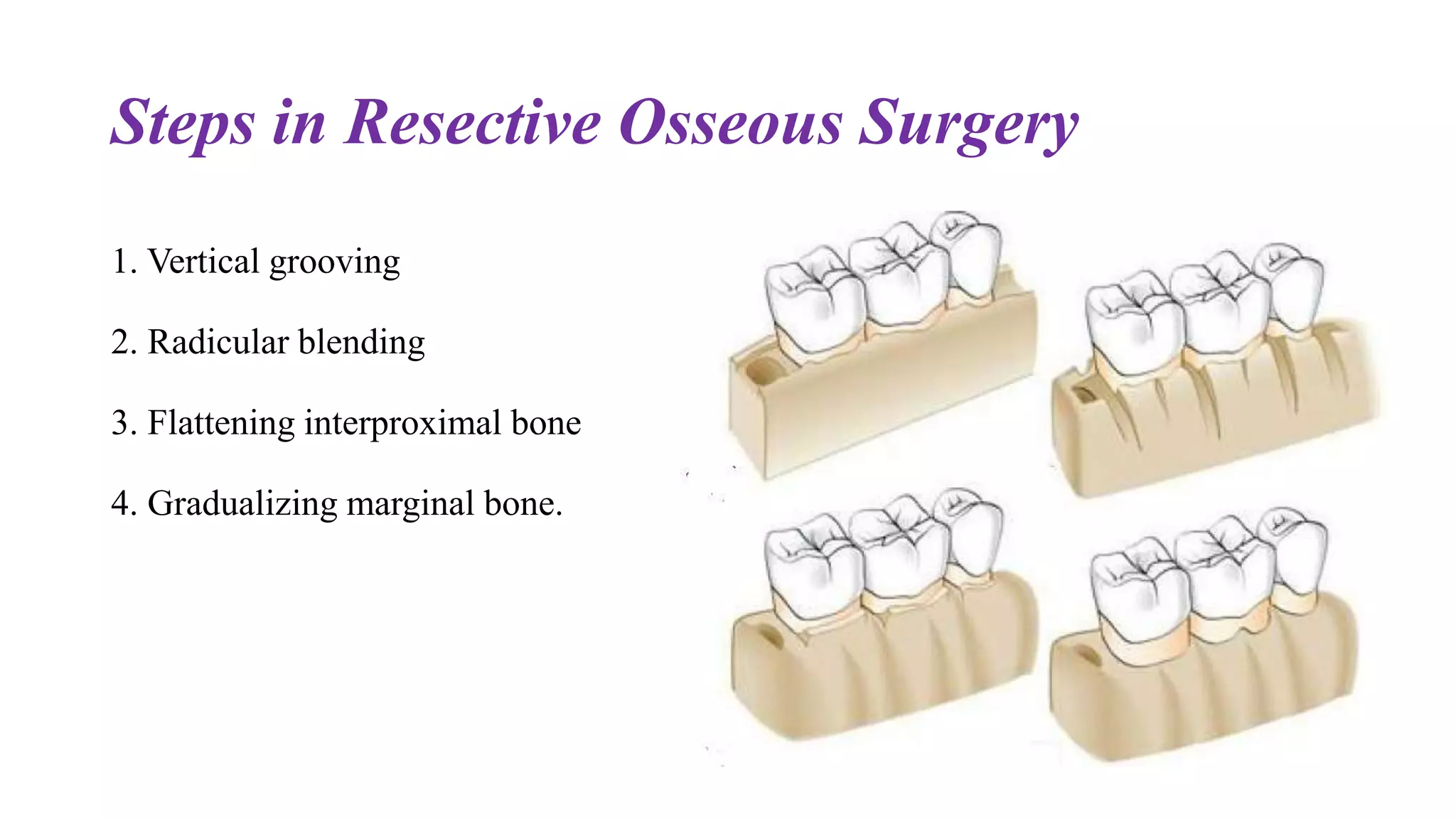 Resective osseous surgery | PPTX