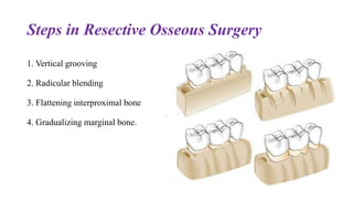 Resective osseous surgery | PPTX