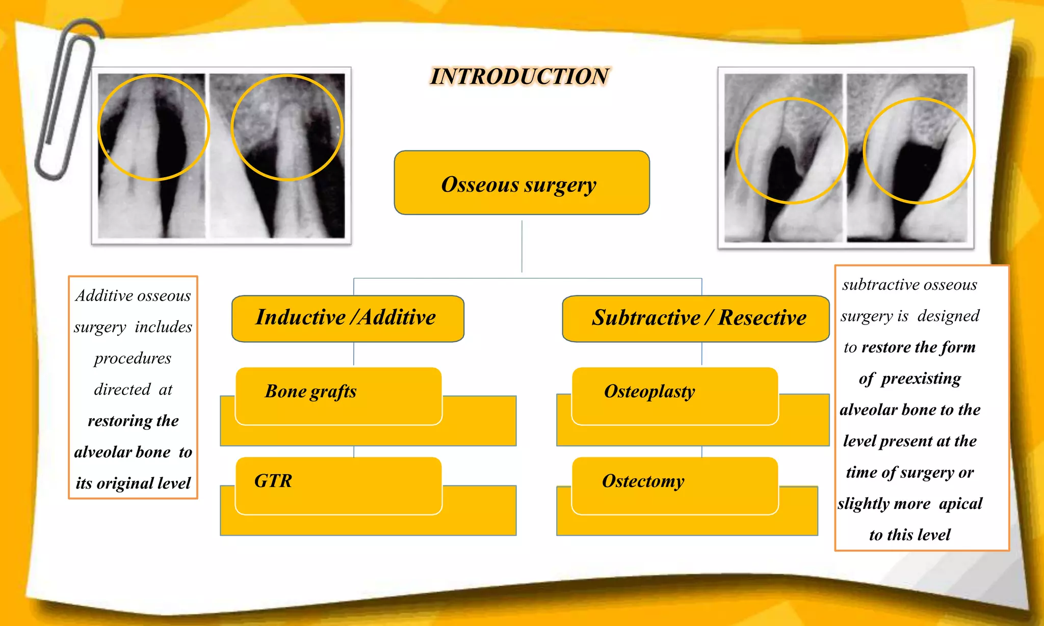 Resective osseous surgery | PPTX