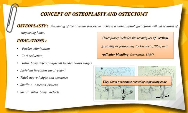 Resective osseous surgery | PPTX | Bone and Joint Conditions | Diseases ...