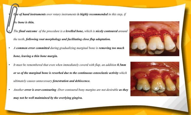 Resective osseous surgery | PPTX | Bone and Joint Conditions | Diseases ...