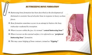 Resective osseous surgery | PPT