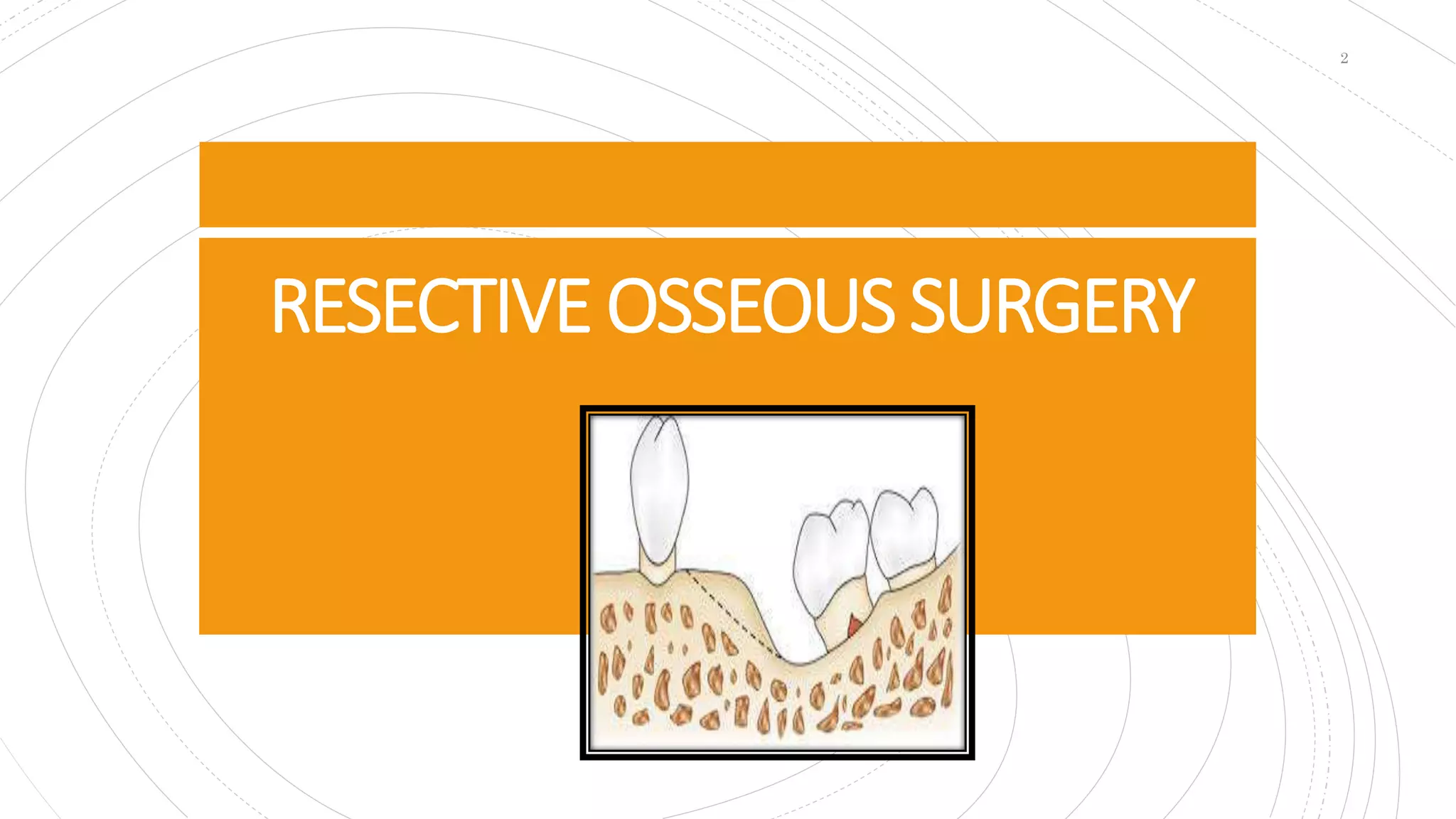 RESECTIVE OSSEOUS SURGERY.pptx