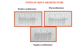 RESECTIVE OSSEOUS SURGERY.pptx