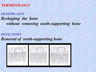 RESECTIVE OSSEOUS SURGERY.ppt