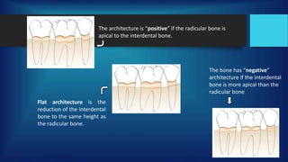 resective osseous surgeryyy.pptx