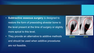 resective osseous surgeryyy.pptx