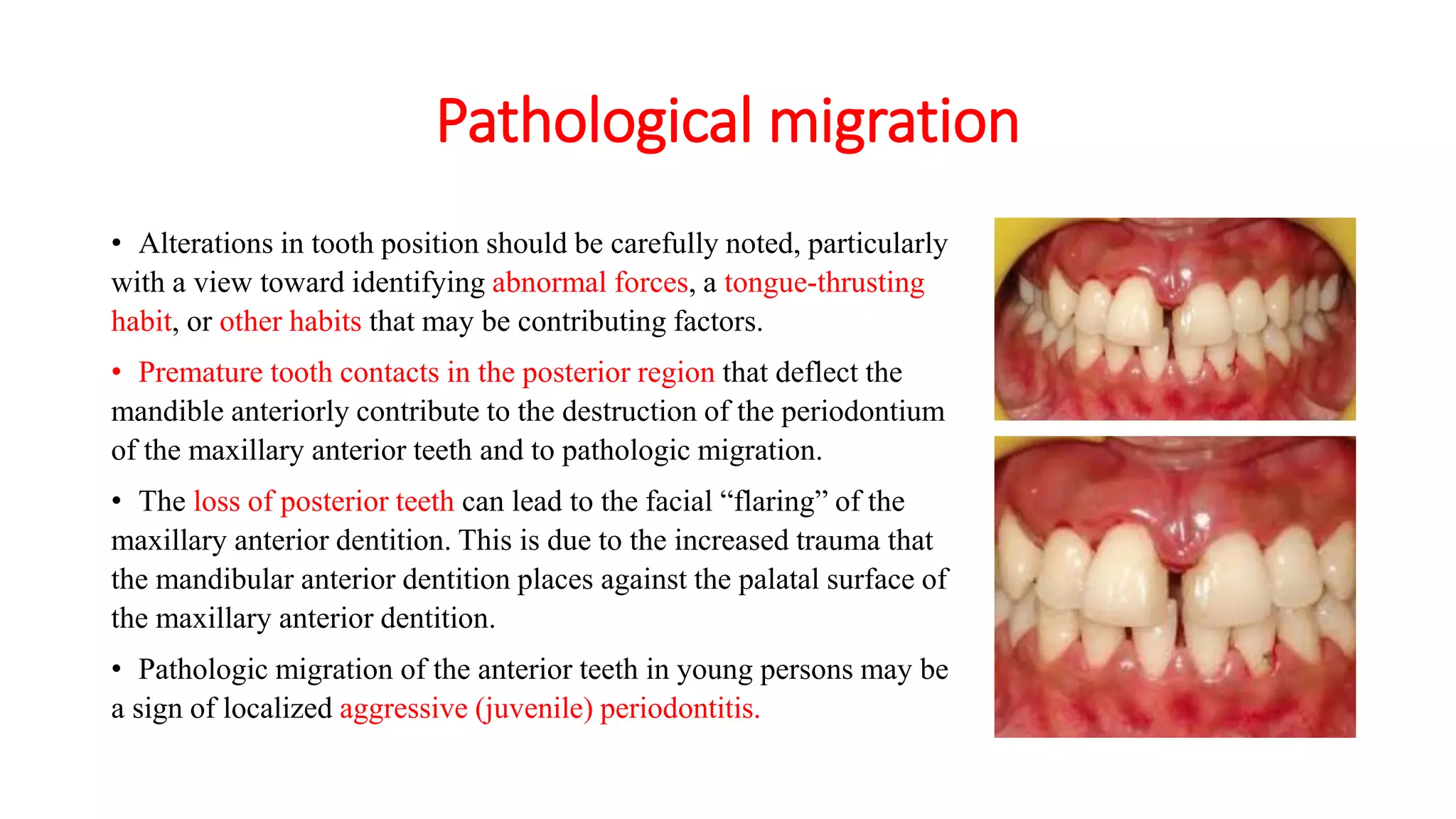 Diagnosis of periodontal disease | PPSX