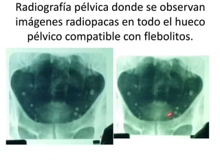 resumen examen final uro.pptx
