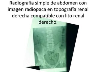 resumen examen final uro.pptx