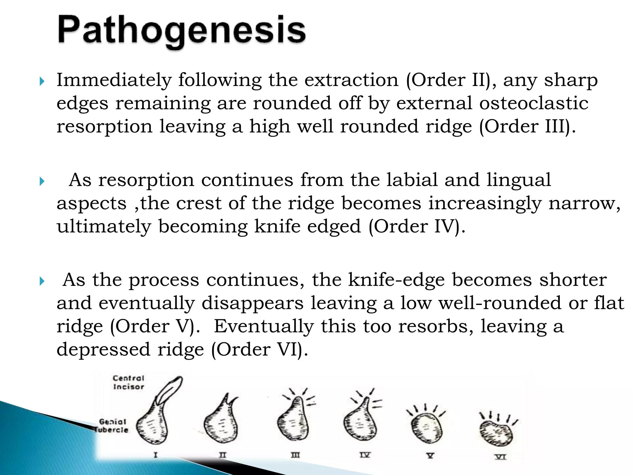 Residual ridge resorption | PPTX