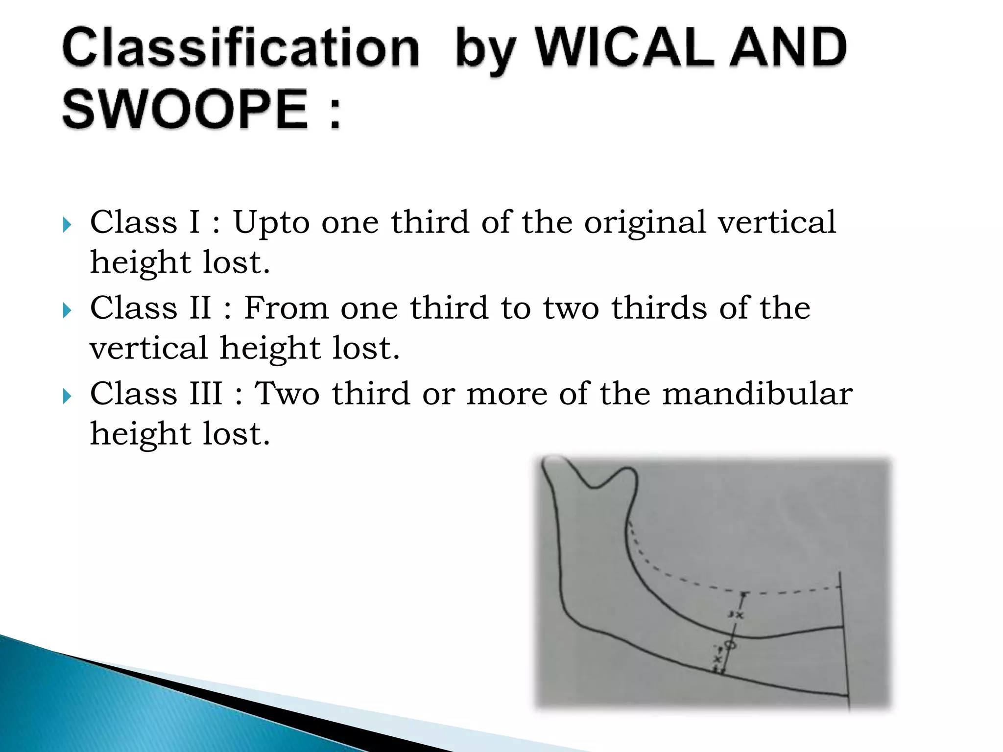 Residual ridge resorption | PPTX
