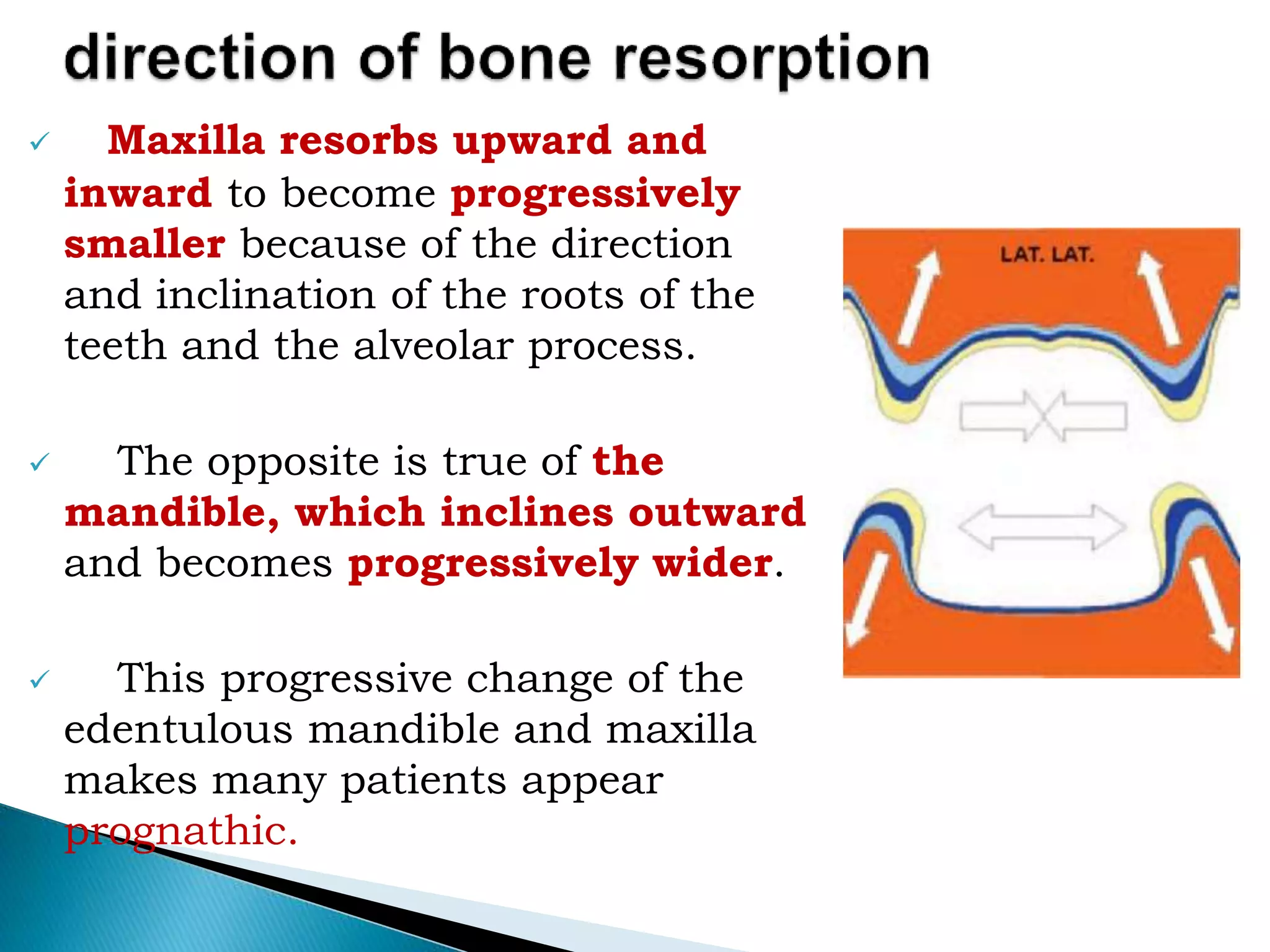 Residual ridge resorption | PPTX | Bone and Joint Conditions | Diseases ...