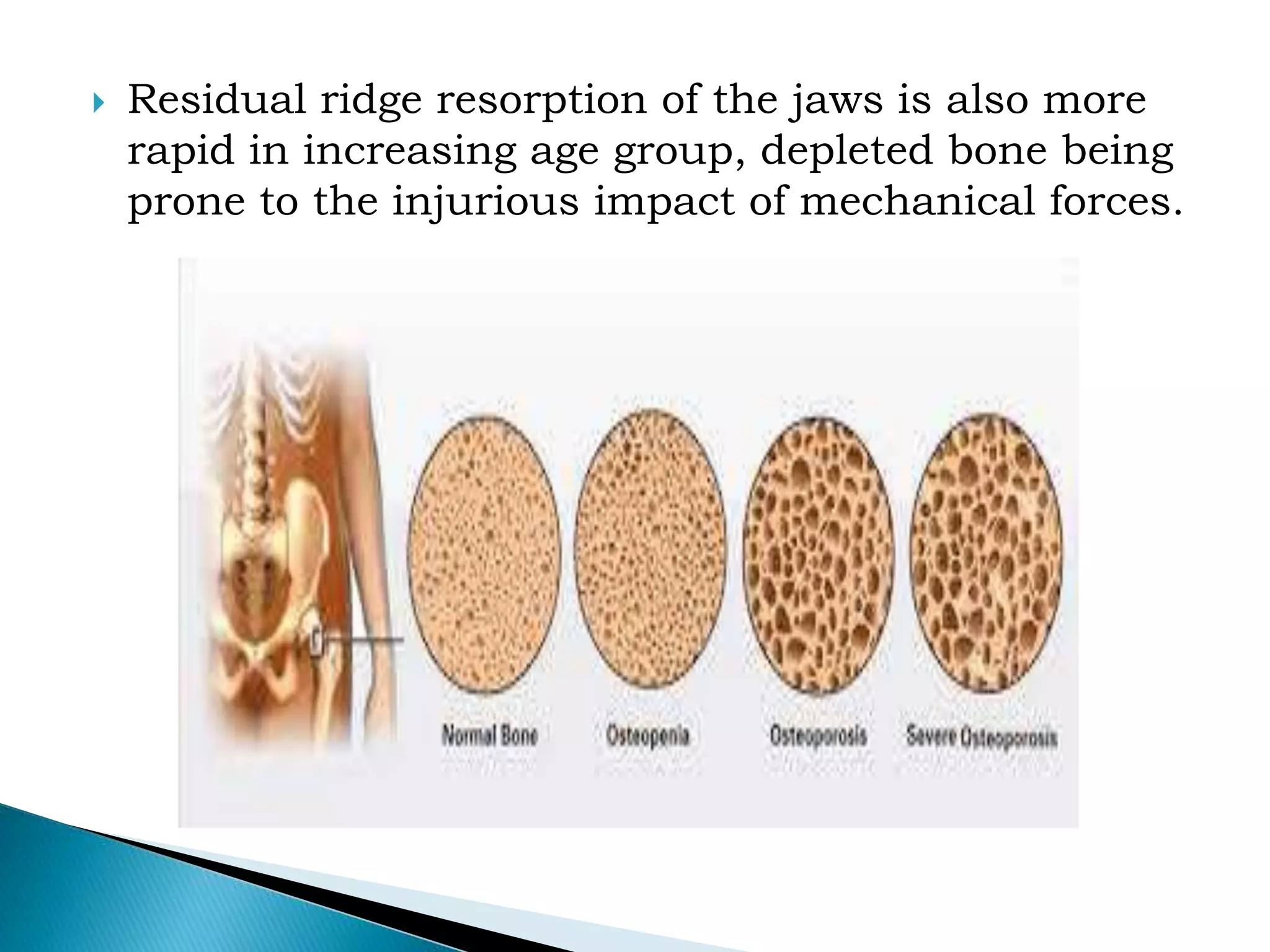 Residual ridge resorption | PPTX | Bone and Joint Conditions | Diseases ...
