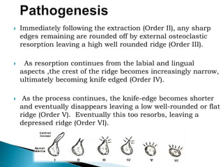 Residual ridge resorption | PPTX