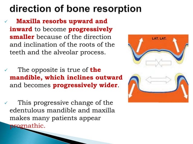 Residual ridge resorption | PPTX | Bone and Joint Conditions | Diseases ...