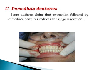 Residual ridge resorption | PPTX
