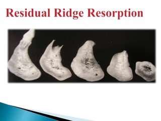 Residual Ridge