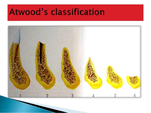 Residual ridge resorption