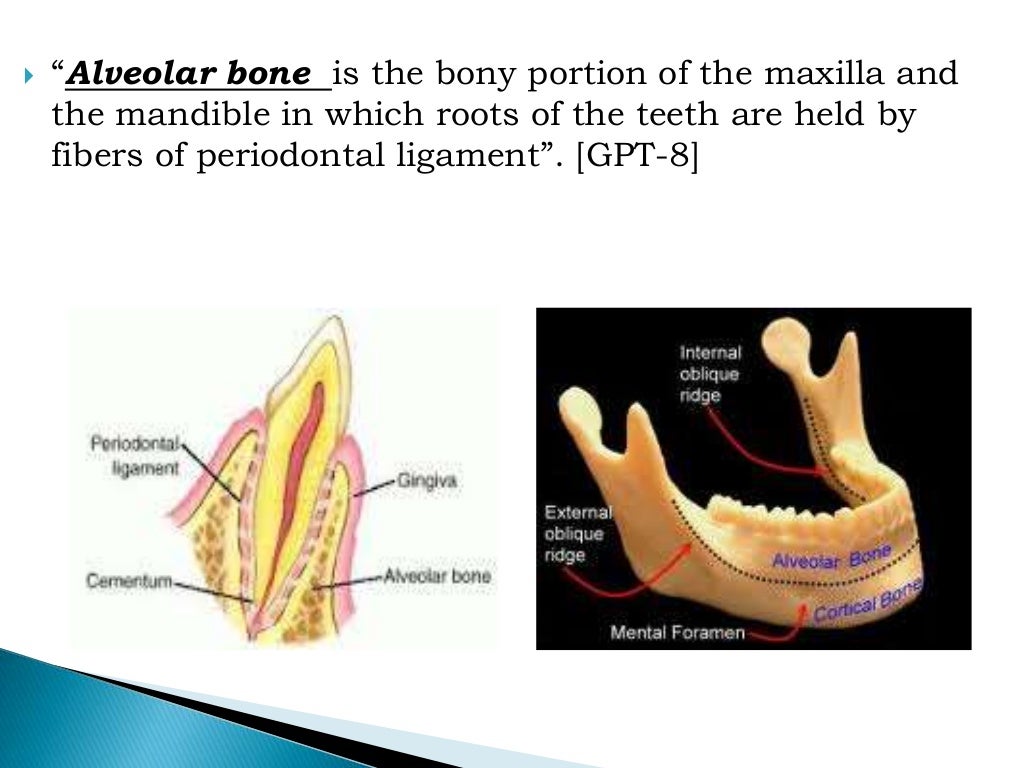 Residual ridge resorption