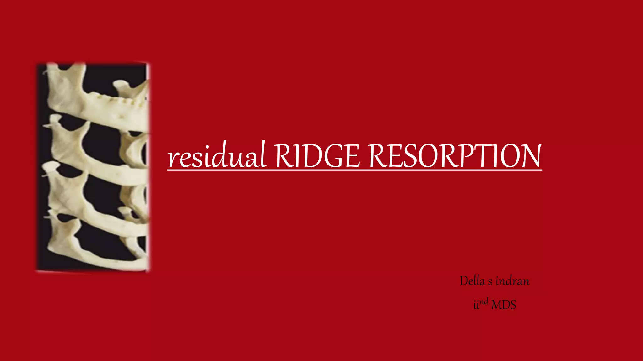 Residual ridge resorption | PPTX | Dental Health | Diseases and Conditions