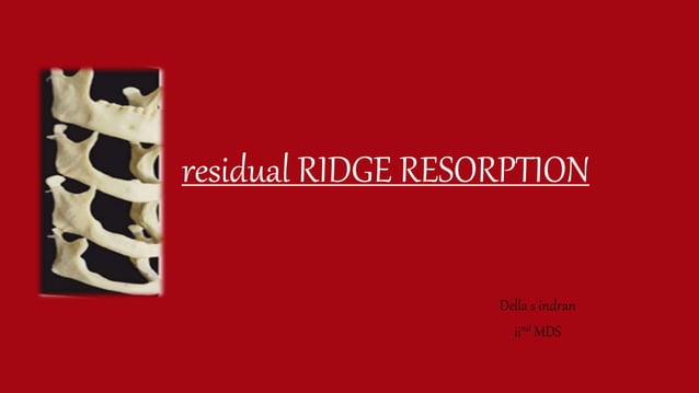 Residual ridge resorption | PPTX | Dental Health | Diseases and Conditions