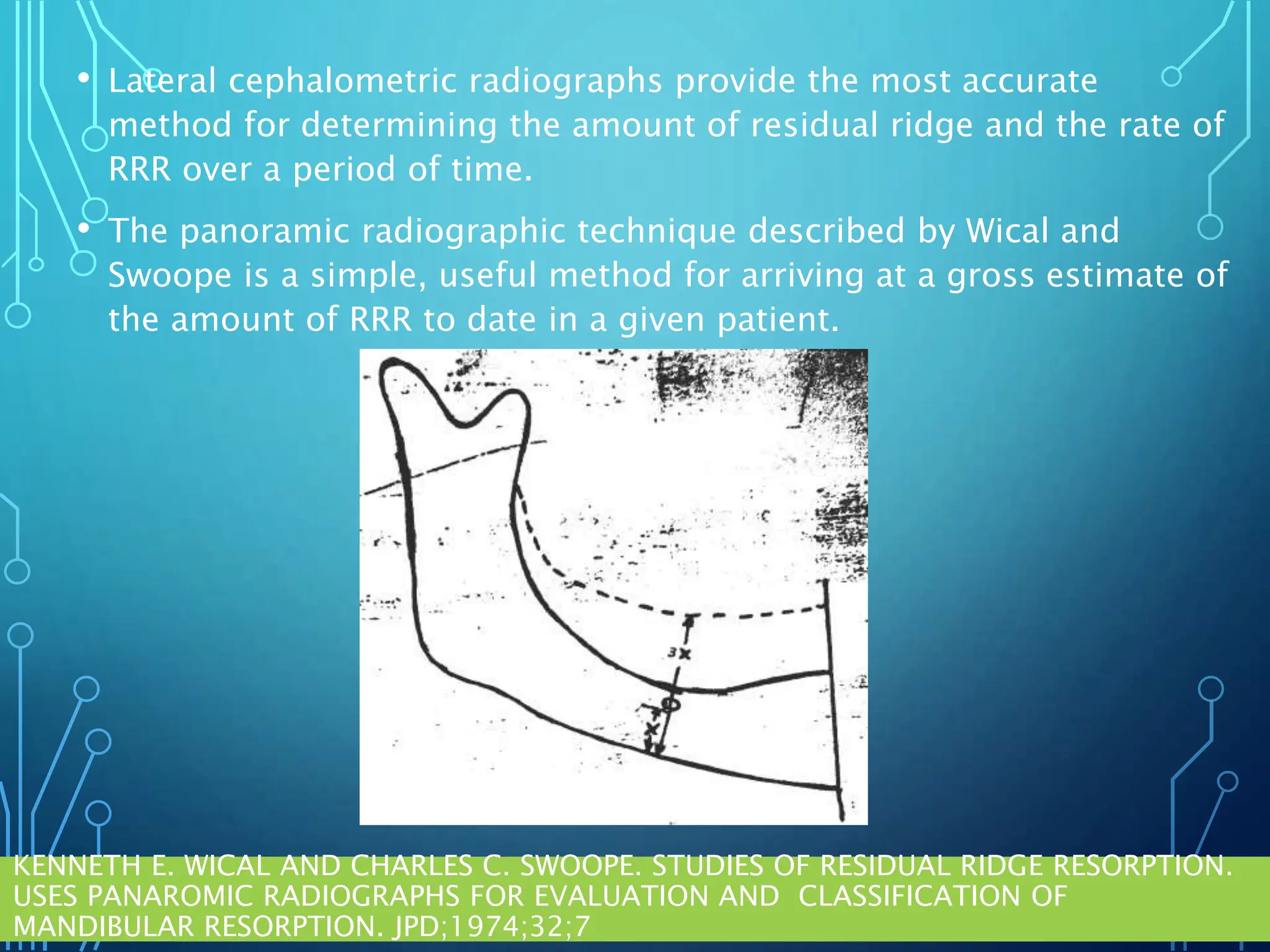 residual ridge resorption in cd patients | PPT
