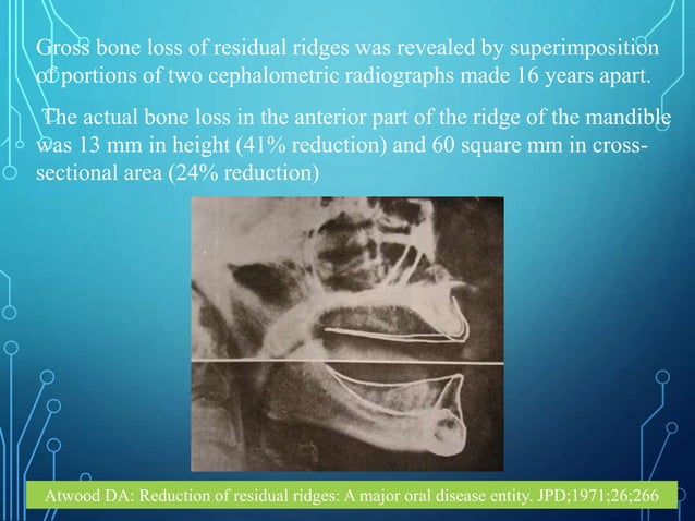 residual ridge resorption in cd patients | PPT