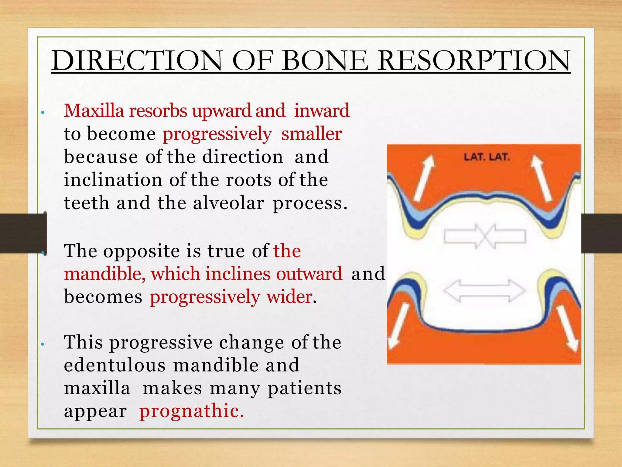 Residual ridge resorption | PPTX