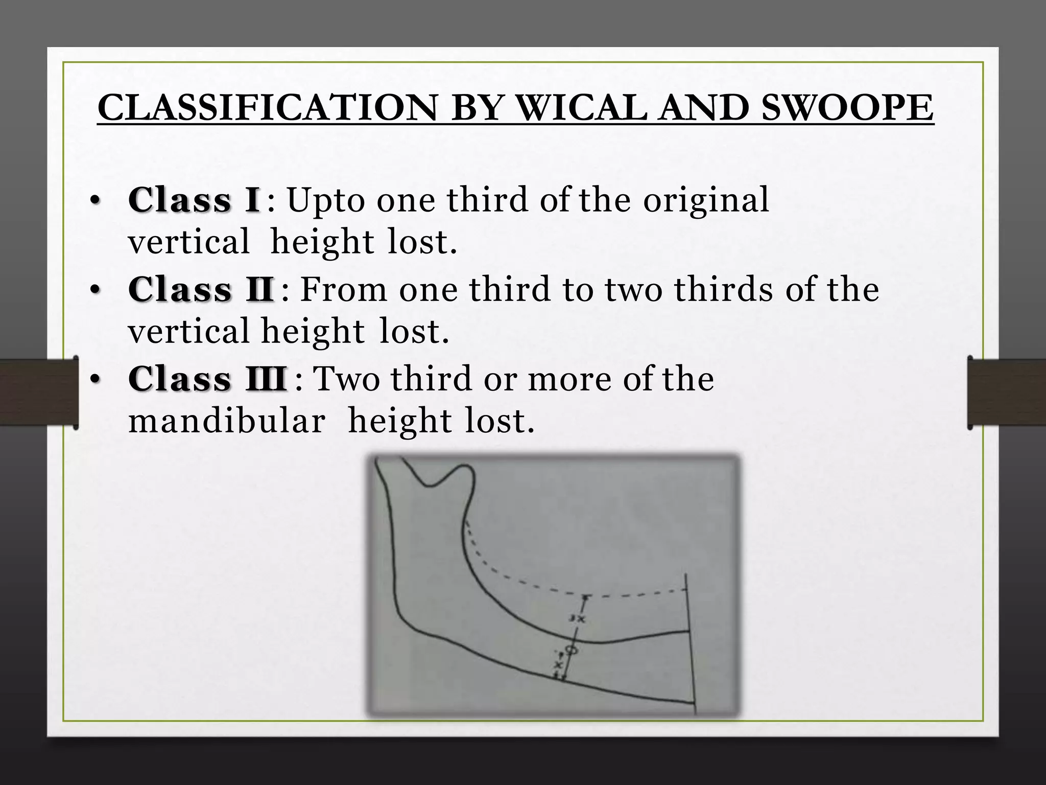 Residual ridge resorption | PPTX