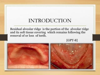 Residual ridge resorption | PPTX