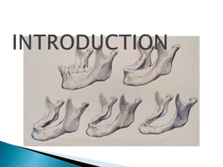 PROSTHODONTIC MANAGEMENT OF RESIDUAL RIDGE REDUCTION | PPT